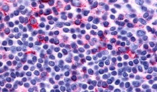 LTB4R2 Polyclonal Antibody, Invitrogen 50 μg; Unconjugated:Anticuerpos ...