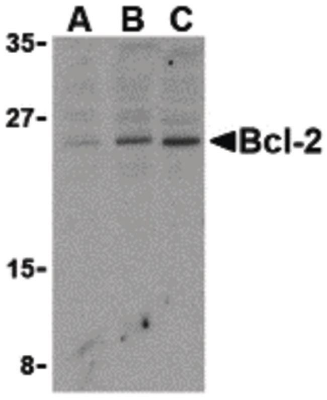 Bcl-2 Polyclonal Antibody, Invitrogen™ 100 μg; Unconjugated Primary ...