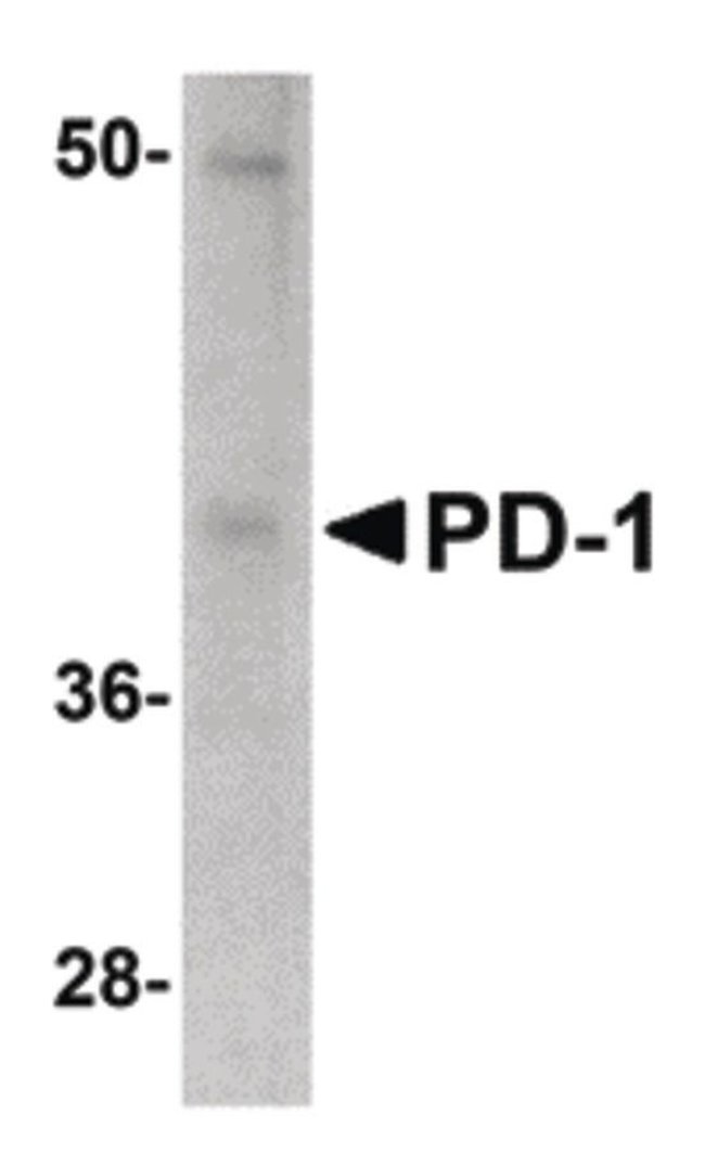 PD-1 Mouse anti-Human, Mouse, Rat, Clone: 12A7D7, Invitrogen 100 µg ...