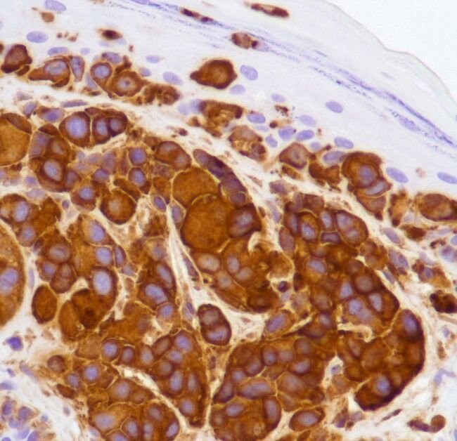 CD63 Mouse anti-Human, Clone: SPM524, Invitrogen 500 µL; Unconjugated ...