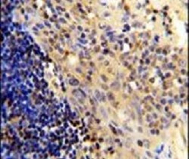 CD8 alpha Polyclonal Antibody, Invitrogen™ 400 μL; Unconjugated Primary ...