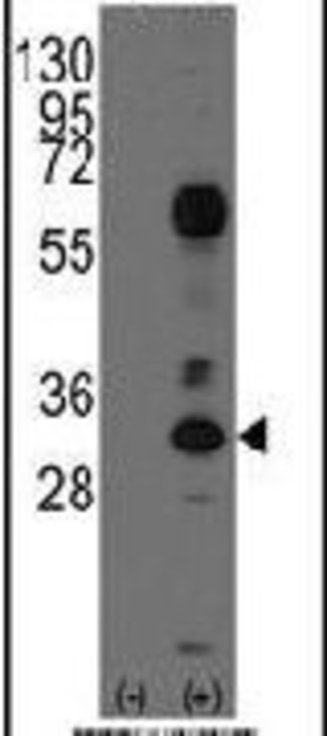 CD8 alpha Polyclonal Antibody, Invitrogen™ 400 μL; Unconjugated Primary ...