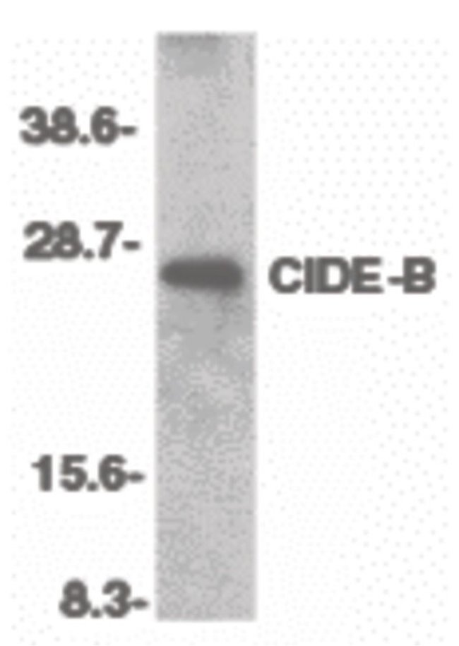 CIDEB Rabbit anti-Mouse, Polyclonal, Invitrogen™ 100 μg; Unconjugated ...