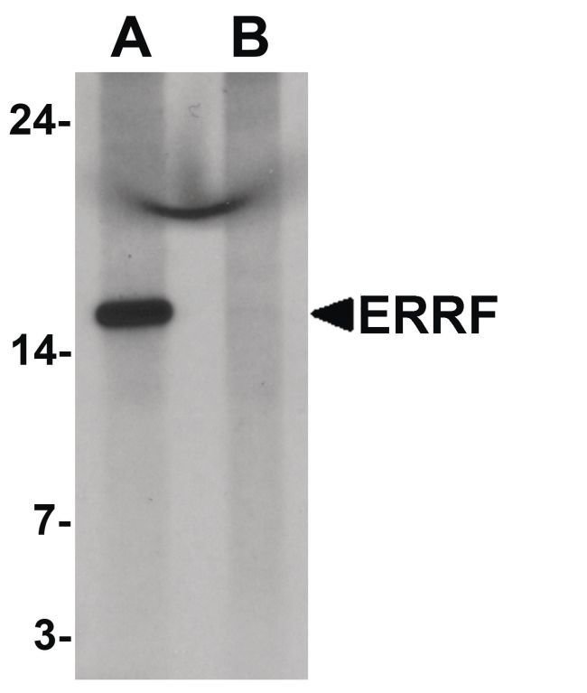 ERRF Polyclonal Antibody, Invitrogen™ 100 μg; Unconjugated Primary ...