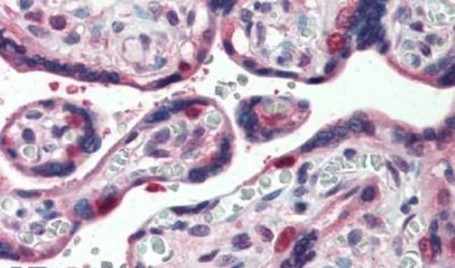 GLG1 Polyclonal Antibody, Invitrogen™ 50 μg; Unconjugated | Fisher ...