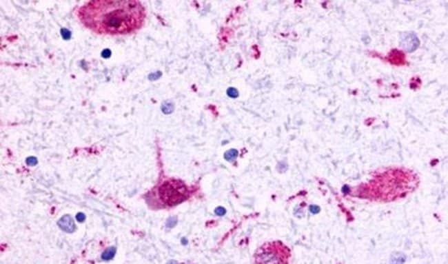 GPR17 Polyclonal Antibody, Invitrogen 50 μg; Unconjugated:Antibodies ...