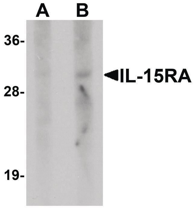 IL15RA Polyclonal Antibody, Invitrogen™ 100 μg; Unconjugated Primary ...