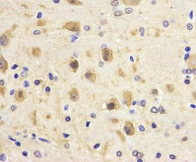 LC3A/LC3B Polyclonal Antibody, Invitrogen™ 100 μL; Unconjugated Primary ...