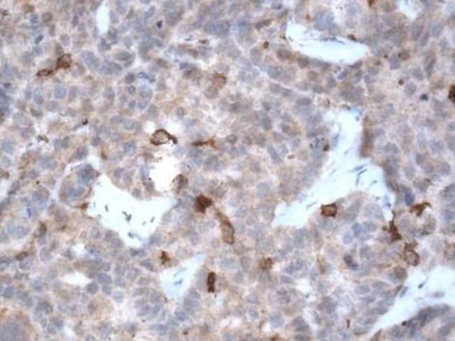 LC3A/LC3B Polyclonal Antibody, Invitrogen™ 100 μL; Unconjugated Primary ...