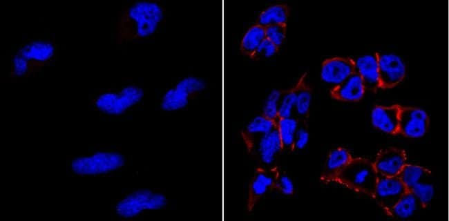 TRA-1-81 Monoclonal Antibody (TRA-1-81), DyLight 550, Invitrogen 100 μL ...