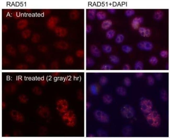 RAD51 Monoclonal Antibody (14B4), Invitrogen 100 μL; Unconjugated:Antibodies, | Fisher Scientific