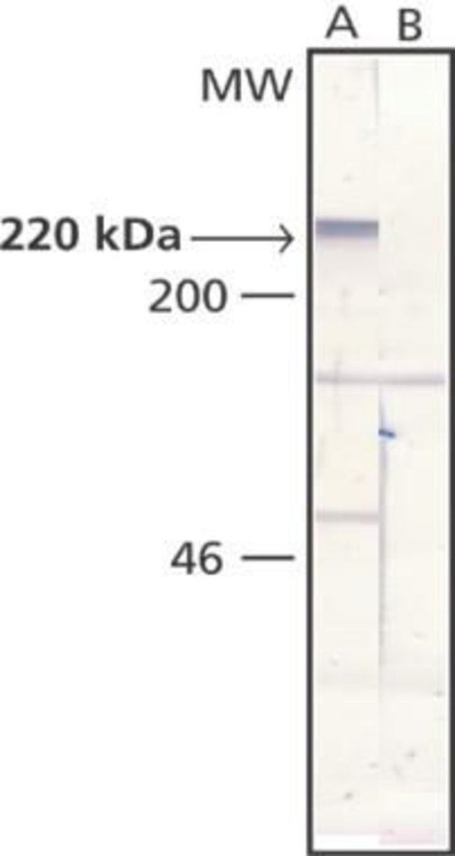 MAP2 Monoclonal Antibody (AP20), Invitrogen™ 50 μL; Unconjugated ...