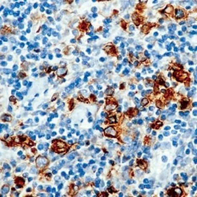 CD15 Monoclonal Antibody (MMA), Invitrogen™ 1 mL; Unconjugated | Fisher ...