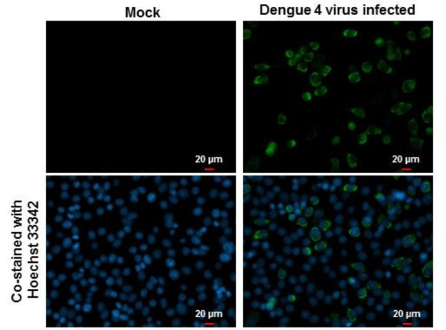 Dengue Virus Type 1-4 Monoclonal Antibody (D1-11(3)), Invitrogen™ 250 ...