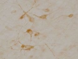 SLC5A7 Monoclonal Antibody (62-2E8), Invitrogen 100 μL; Unconjugated ...