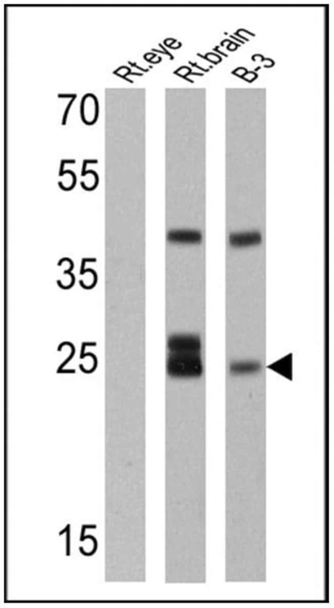 Recoverin Monoclonal Antibody (6a55 cd6), Invitrogen 100 μg ...