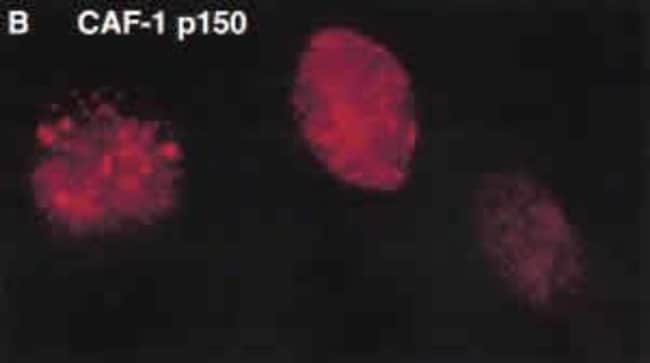 CAF1 p150 Monoclonal Antibody (SS 1 1-13), Invitrogen 200 μL ...