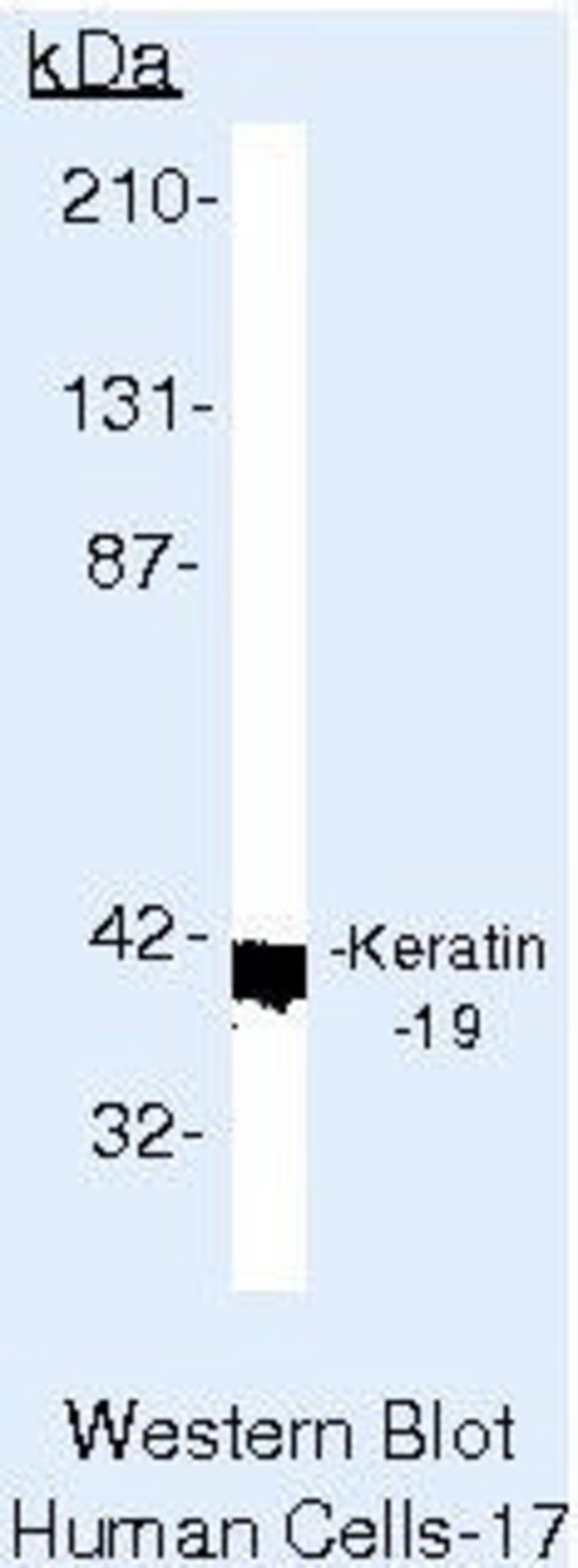 Invitrogen Cytokeratin 19 Monoclonal Antibody (BA17) 500 μL ...
