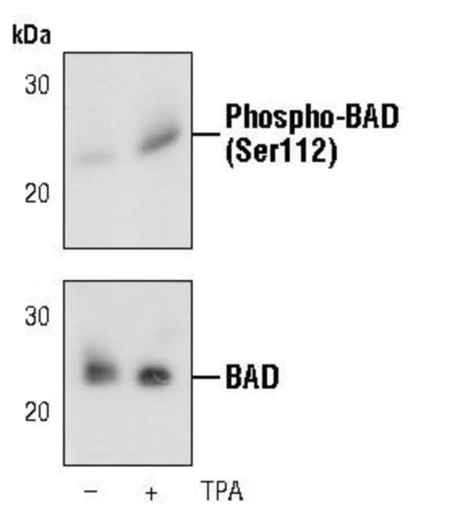 Phospho-BAD (Ser112) Monoclonal Antibody (G.445.9), Invitrogen 100 μL; | Fisher Scientific