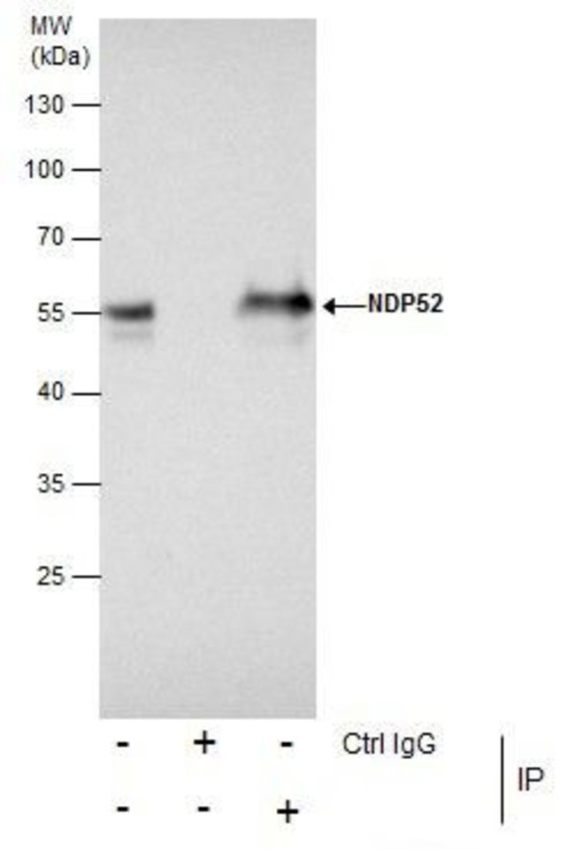 CALCOCO2 Monoclonal Antibody (P422), Invitrogen™ 100 μL; Unconjugated ...