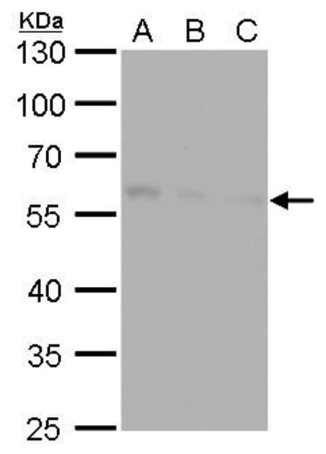 CALCOCO2 Monoclonal Antibody (P422), Invitrogen™ 100 μL; Unconjugated ...