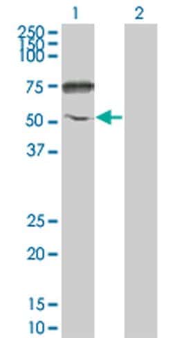 ENPP5 Monoclonal Antibody (1C5-1D7), Invitrogen™ 100 μg; Unconjugated ...