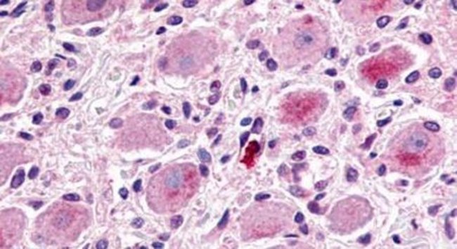 MRGPRX1 Polyclonal Antibody, Invitrogen 50 μg; Unconjugated:Anticuerpos ...
