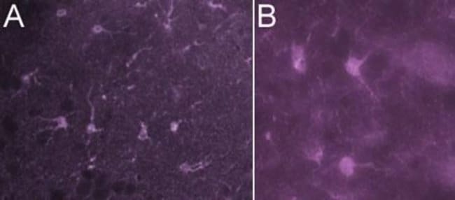 Rabbit anti-Mouse IgG (H+L) Secondary Antibody, TRITC, Invitrogen™ 1 mg ...