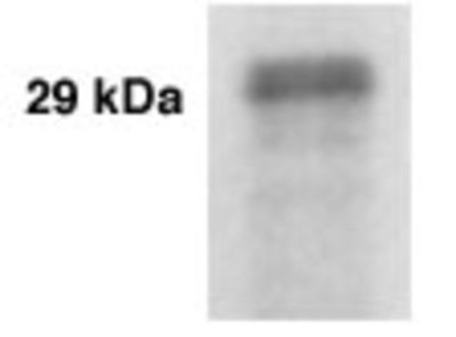 PSA Rabbit anti-Human, Polyclonal, Invitrogen 100 μg; Unconjugated ...
