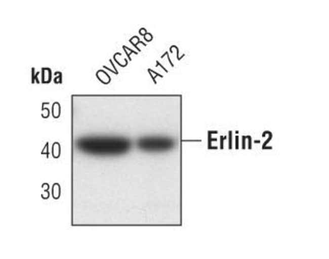 ERLIN2 Polyclonal Antibody, Invitrogen 100 μL; Unconjugated:Antibodies ...