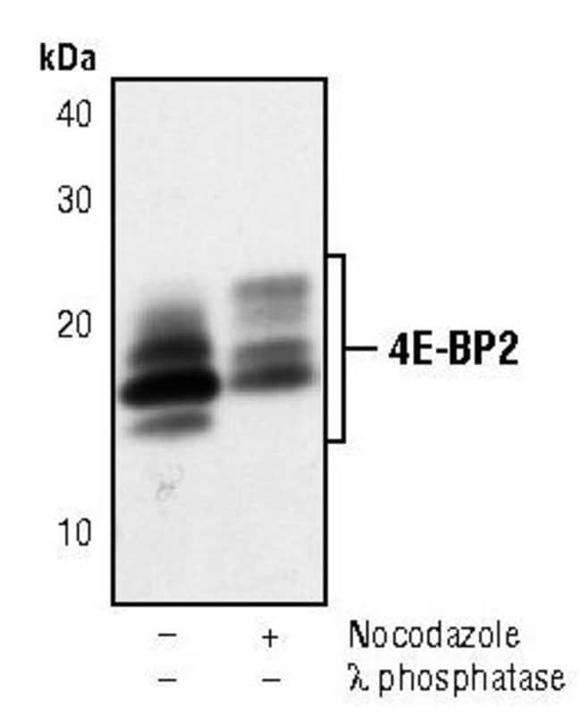 4E-BP2 Rabbit anti-Bovine, Human, Mouse, Non-human primate, Rat ...