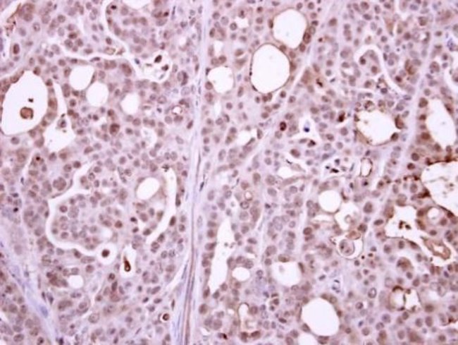 POLR2B Polyclonal Antibody, Invitrogen™ 100 μL; Unconjugated POLR2B ...