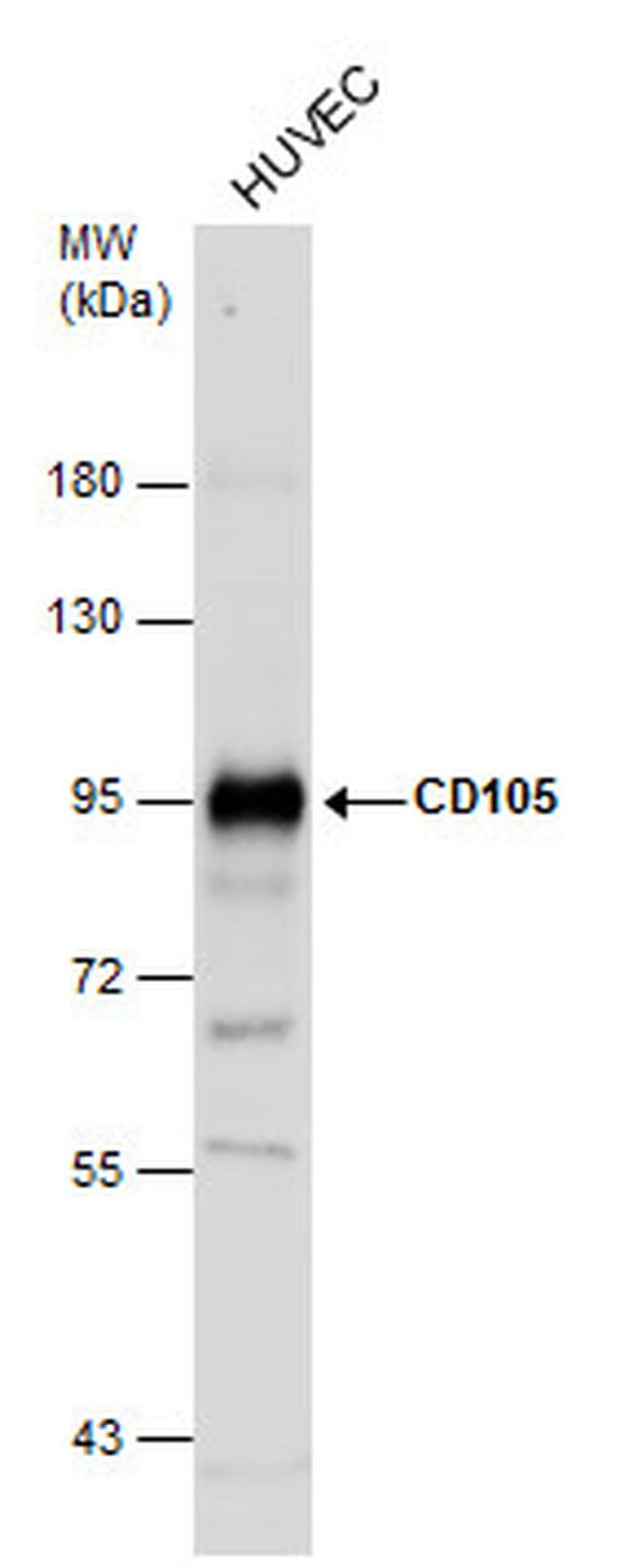 CD105 Polyclonal Antibody, Invitrogen™ 100 μL; Unconjugated CD105 ...