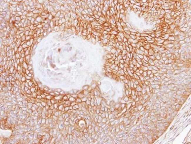 CD105 Polyclonal Antibody, Invitrogen™ 100 μL; Unconjugated Primary ...