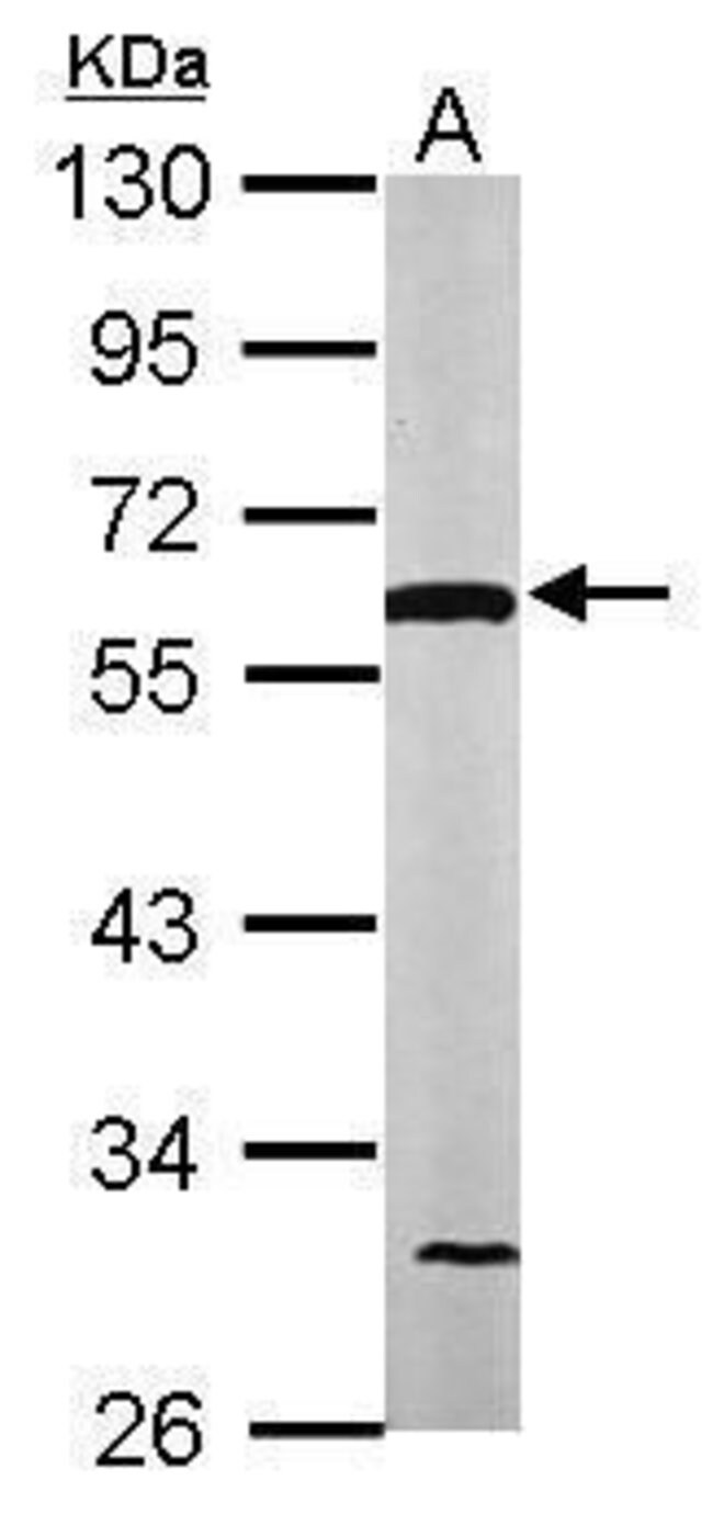 DLD Polyclonal Antibody, Invitrogen 100 μL; Unconjugated:Antibodies ...