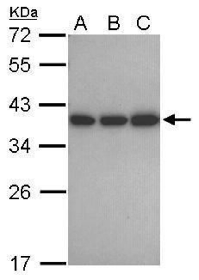 CAPZA1 Polyclonal Antibody, Invitrogen™ 100 μL; Unconjugated Primary ...