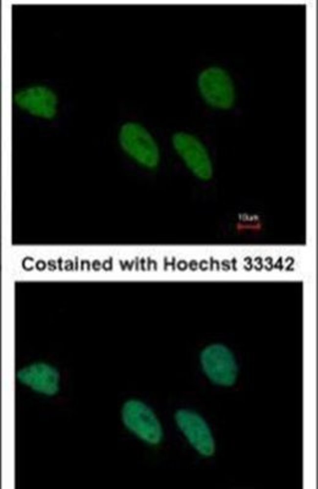 REXO4 Rabbit anti-Human, Polyclonal, Invitrogen™ 100 μL; Unconjugated ...