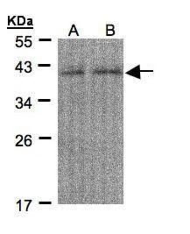 REXO4 Rabbit anti-Human, Polyclonal, Invitrogen™ 100 μL; Unconjugated ...