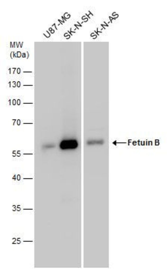 Fetuin B Polyclonal Antibody, Invitrogen™ 100 μL; Unconjugated Primary ...