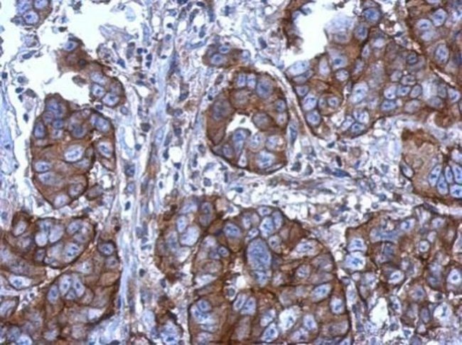 CD11b Polyclonal Antibody, Invitrogen 100 μL; Unconjugated:Antibodies ...