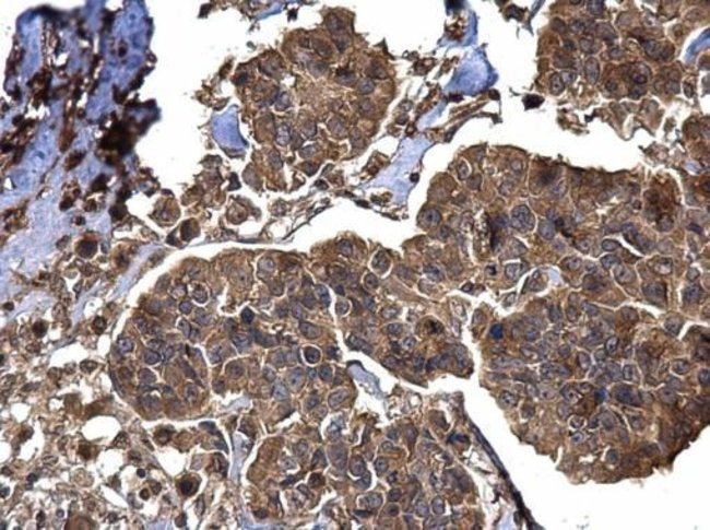 BACE2 Polyclonal Antibody, Invitrogen 100 μL; Unconjugated:Antibodies ...