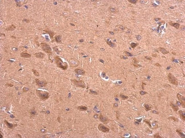 BACE2 Polyclonal Antibody, Invitrogen 100 μL; Unconjugated:Antibodies ...