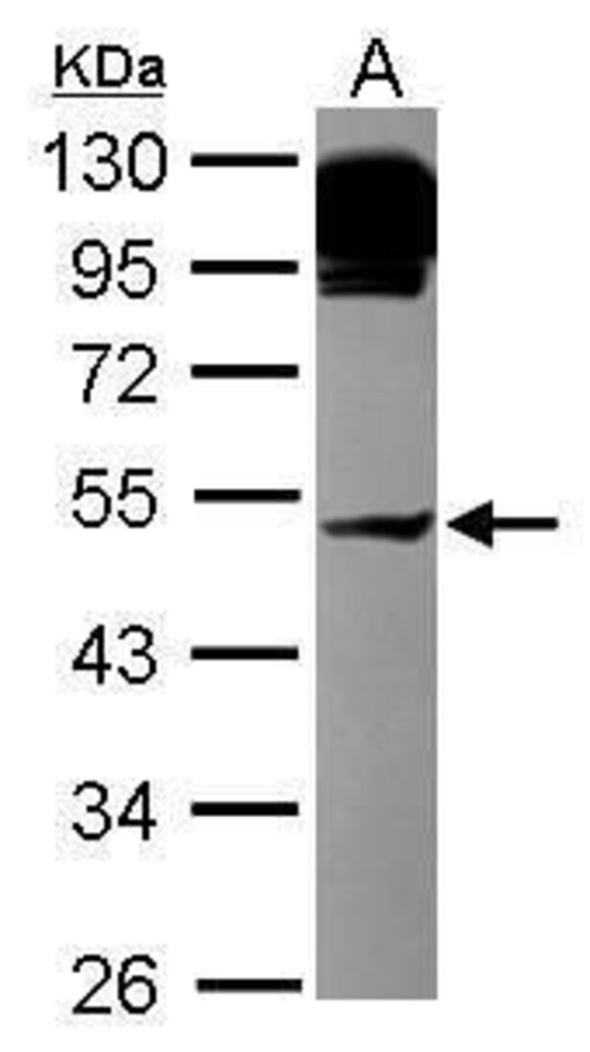 AP4M1 Polyclonal Antibody, Invitrogen 100 μL; Unconjugated:Antibodies ...