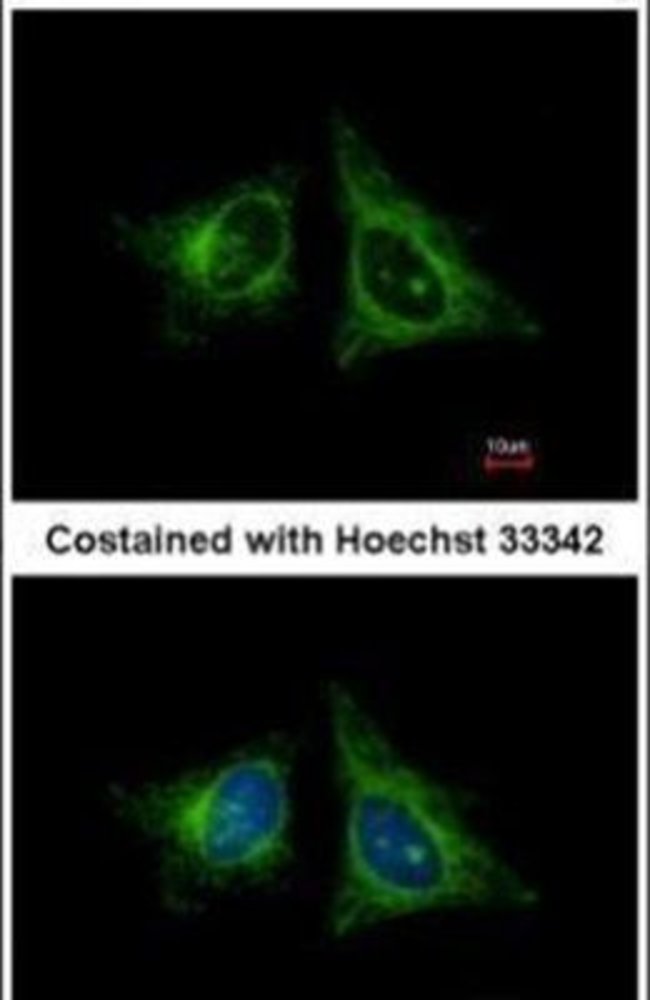 HEBP1 Polyclonal Antibody, Invitrogen 100 μL; Unconjugated:Antibodies ...