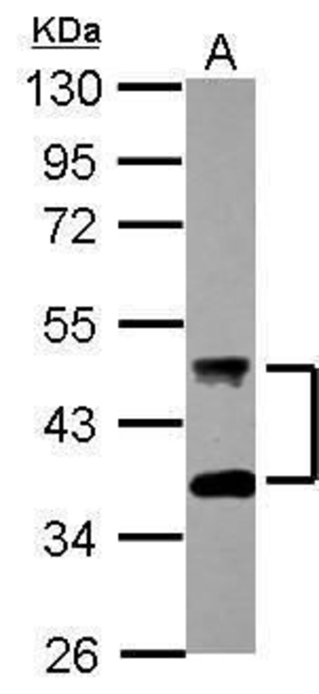 DNAJA4 Rabbit anti-Human, Polyclonal, Invitrogen 100 μL; Unconjugated:Antibodies | Fisher Scientific
