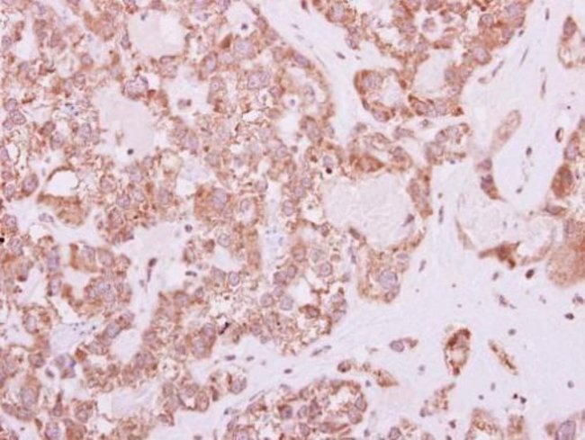 ARF5 Rabbit anti-Human, Mouse, Polyclonal, Invitrogen 100 μL ...