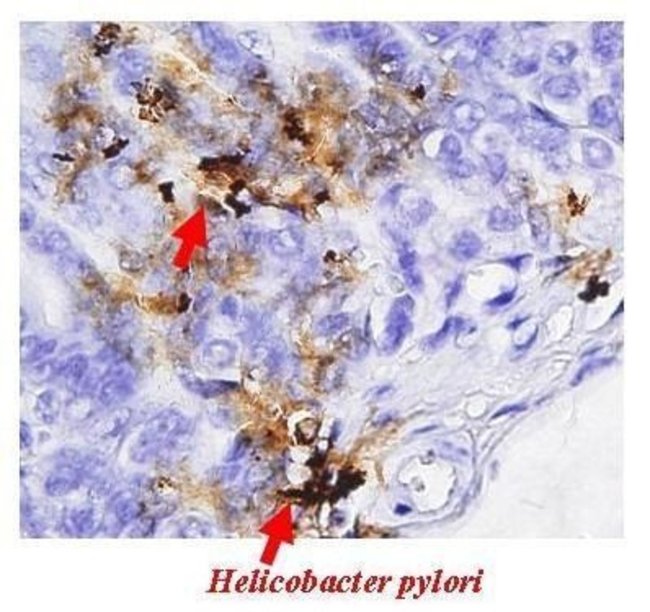 Helicobacter pylori Urease B Rabbit anti-Bacteria, Polyclonal ...