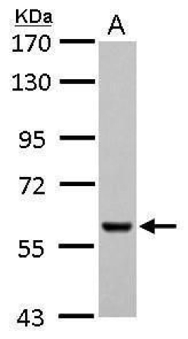 PKLR Polyclonal Antibody, Invitrogen™ 100 μL; Unconjugated Primary ...