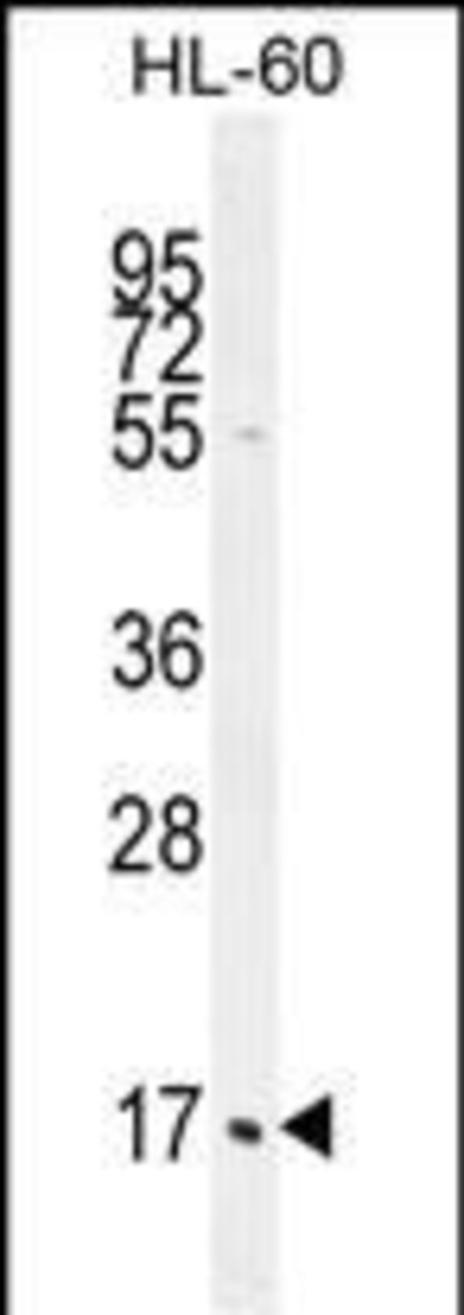 C1QC Polyclonal Antibody, Invitrogen™ 400 μL; Unconjugated Ver ...