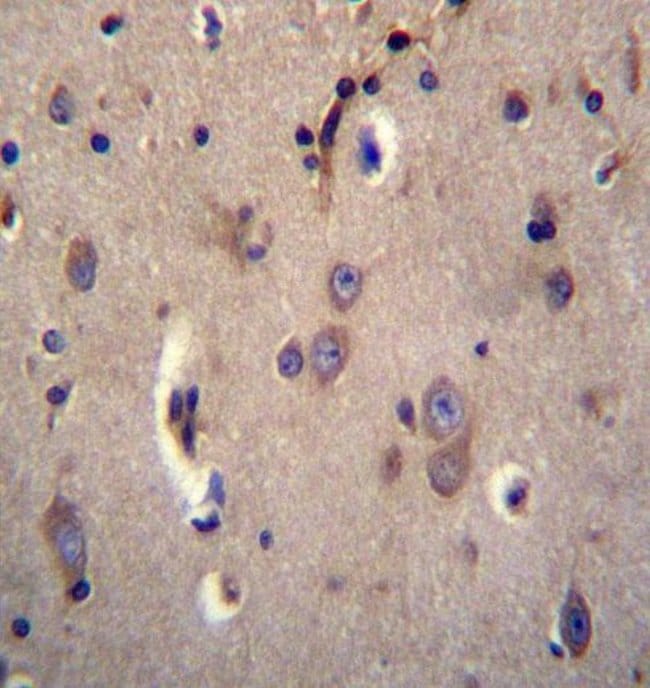 DTNA Polyclonal Antibody, Invitrogen 400 μL; Unconjugated:Antibodies ...